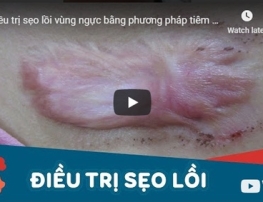 Tiêm sẹo lồi bao nhiêu tiền? Có hết không? Bao lâu thì xẹp?