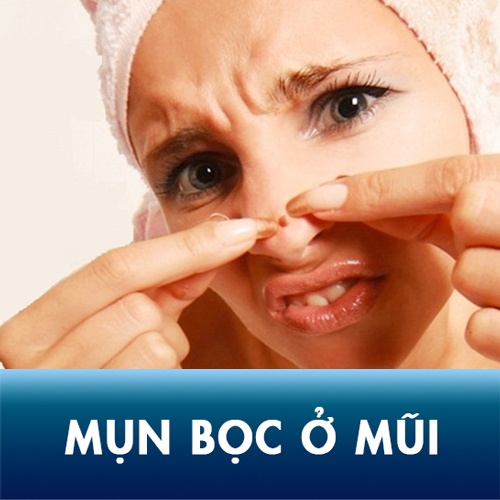 Mụn Bọc ở Mũi: 4 Nguyên nhân & 6 Cách trị hiệu quả nhất
