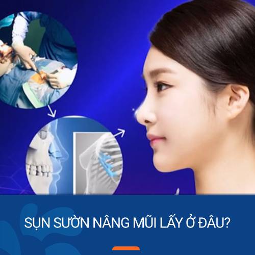 Sụn sườn nâng mũi lấy ở đâu? 7 ưu điểm khi nâng mũi sụn sườn
