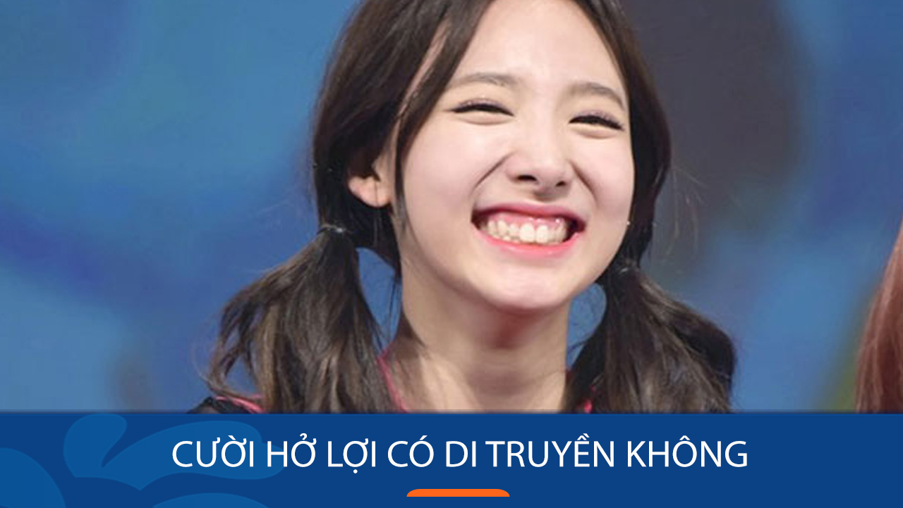 Nụ cười hở lợi: Nguyên nhân di truyền và giải pháp điều trị hiệu quả