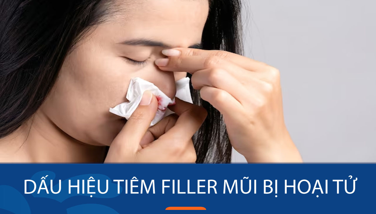Các Dấu hiệu tiêm filler mũi bị hoại tử : các lưu ý đặc biệt