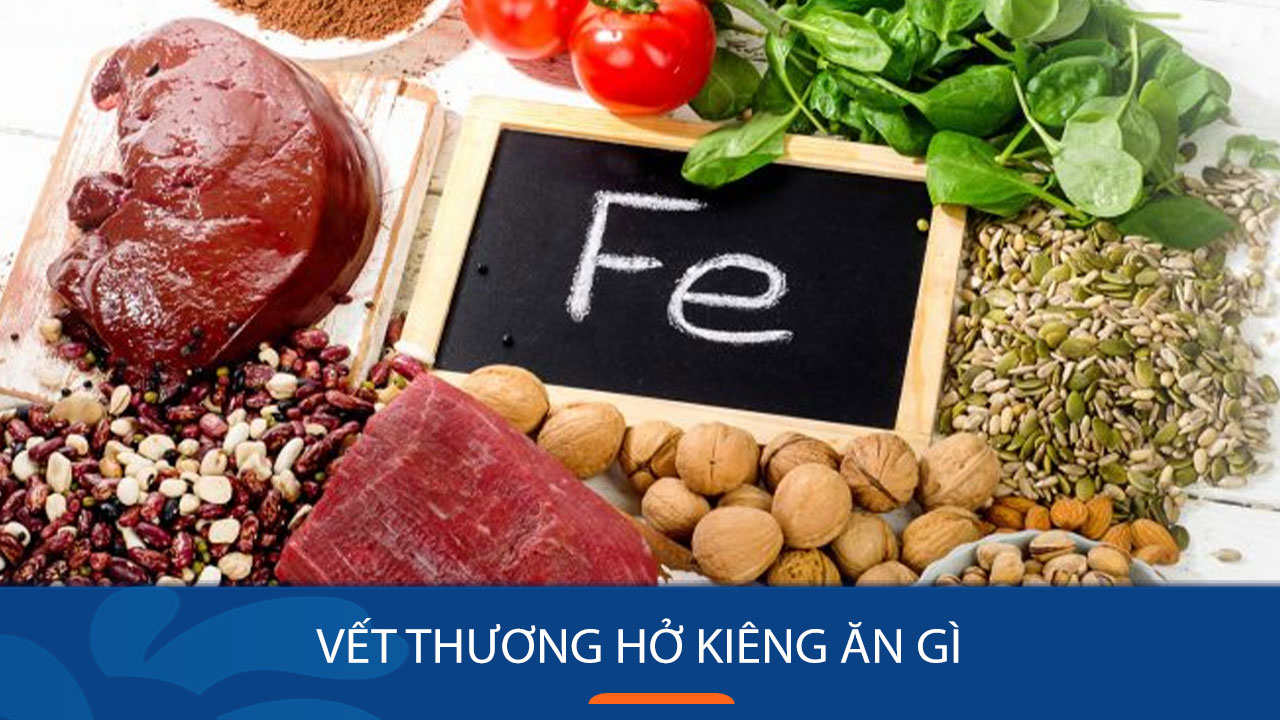 Vết thương hở kiêng ăn gì? 8 thực phẩm xóa sổ để không bị sẹo