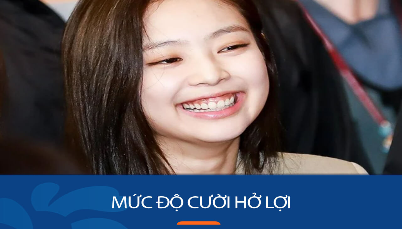 Giải mã nụ cười hở lợi: Nguyên nhân, phân loại và bí quyết che giấu